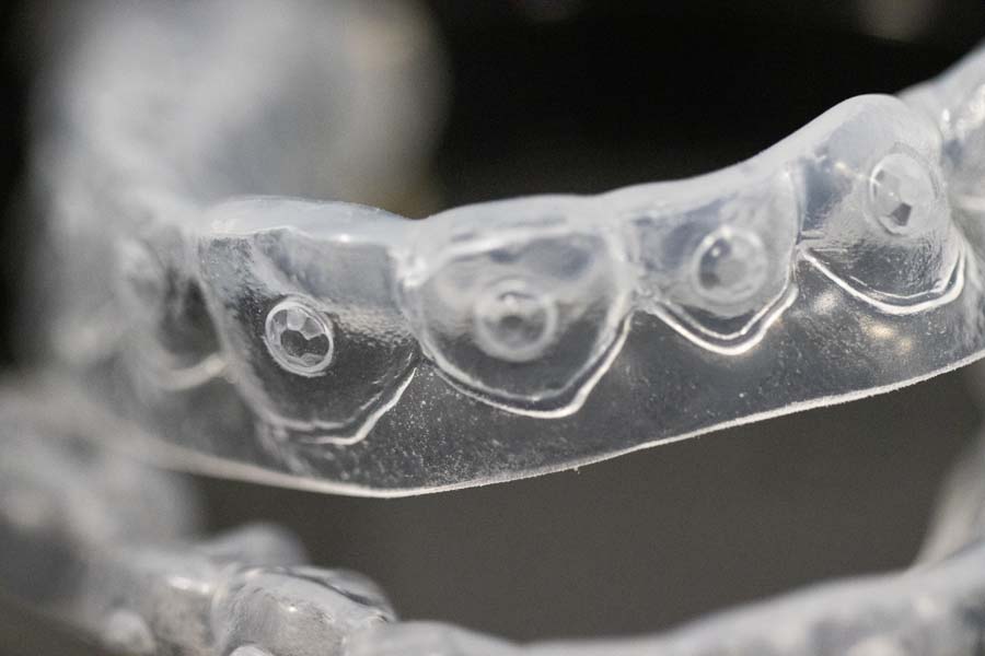 Stained/Discoloured Teeth - Haugh Dental